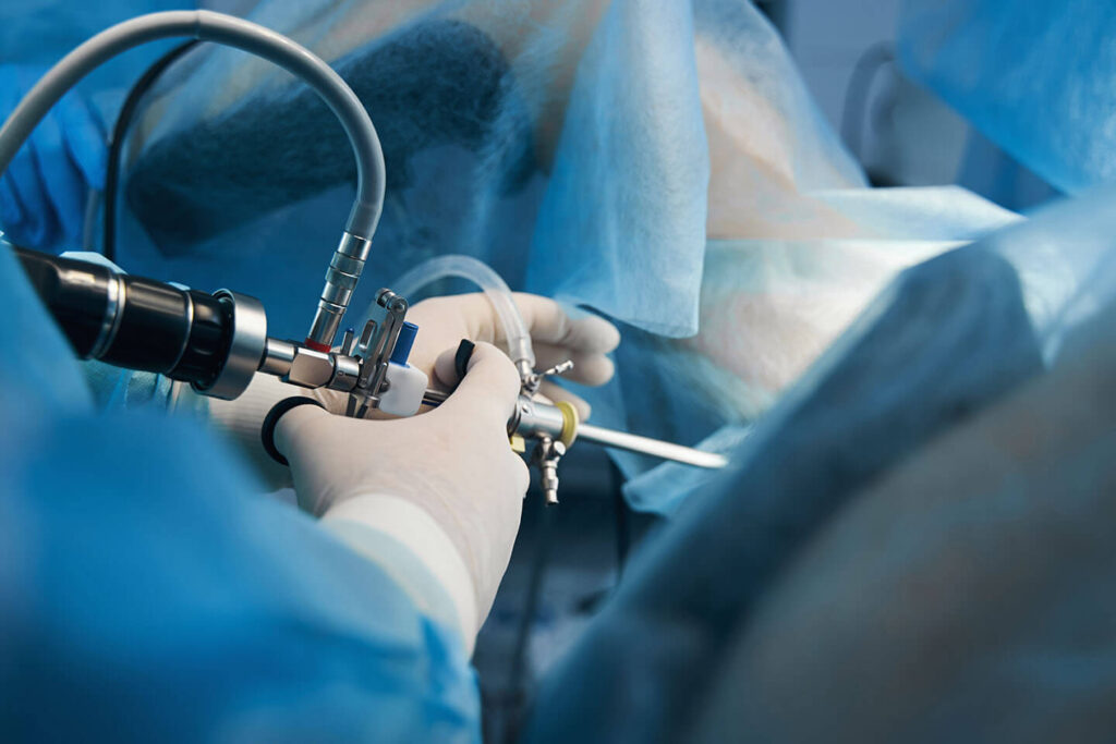 Knee Arthroscopy – Vahan Cepkinian, M.D.